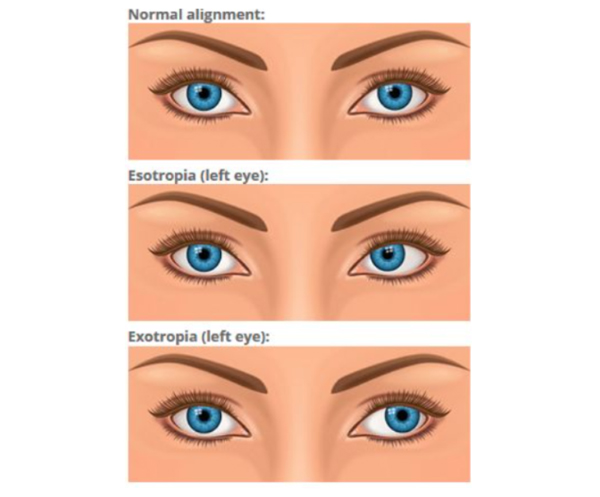 Physiotherapy and treatment options for individuals with Arthritis